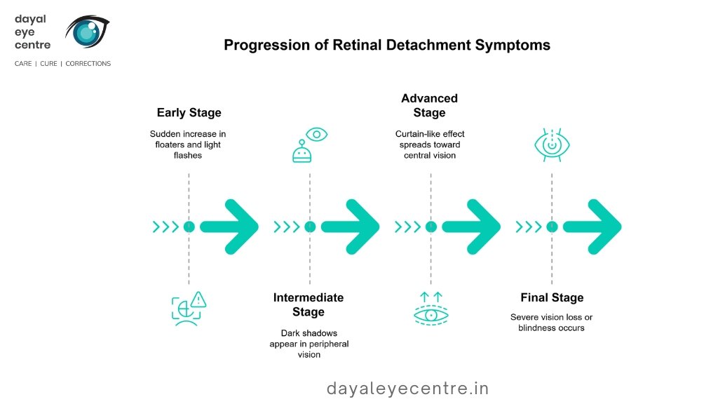 Retinal Detachment Treatment in Eluru | Vijaya Eye Hospital