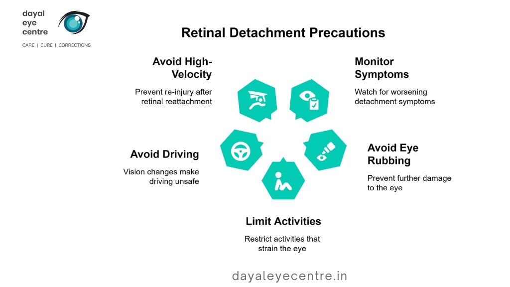 Retinal Detachment Treatment in Eluru | Vijaya Eye Hospital